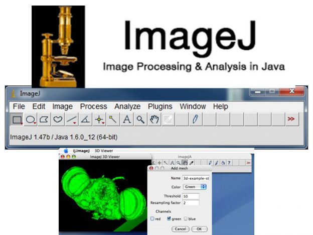 Module 2 : Automatisation de tâche sous ImageJ : les macros – LVTS UMRS1148 INSERM UP Cité USPN