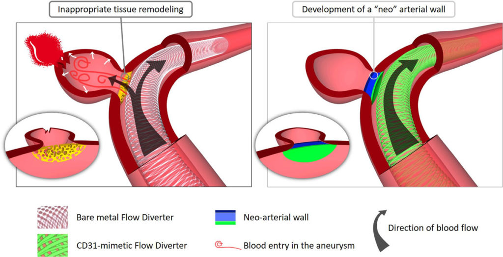 CD31 Mimetic Coating Enhances Flow Diverting Stent Integration – LVTS ...