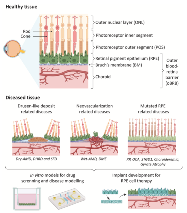 Engineering of the outer blood-retina barrier – LVTS UMRS1148 INSERM UP Cité USPN